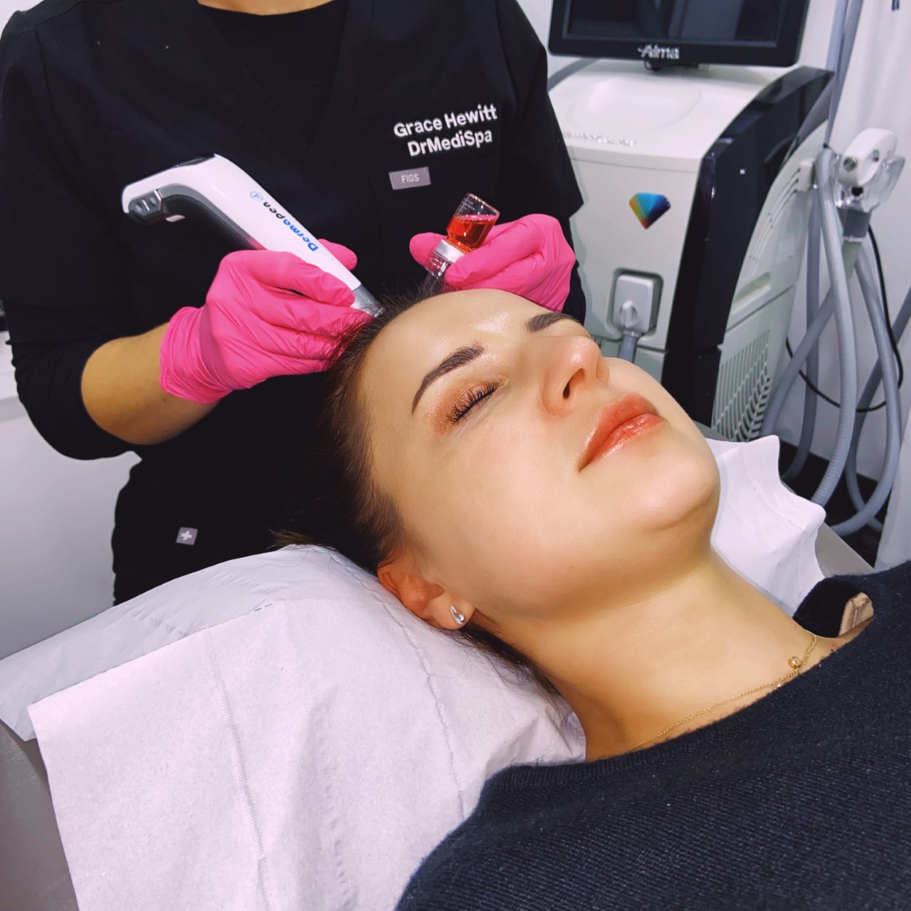 Thinning hair? Receding hairline? This micro needling scalp treatment ...